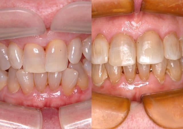 Prof. Sadao Sato, DDS., PhD. - IDEA Hands-On Courses on Orthodontics
